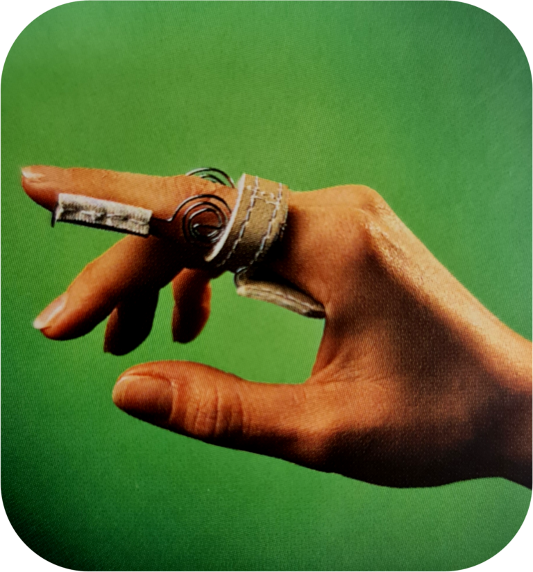 Spring Mallet Finger | CAP1 | Abu Lail Medical & Sport Center