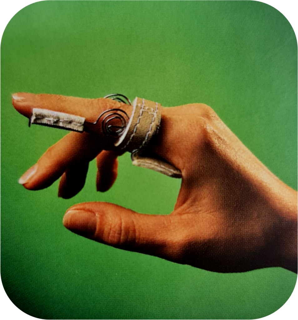 Spring Mallet Finger | CAP1 | Abu Lail Medical & Sport Center