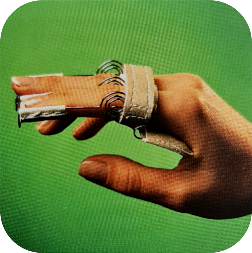 Spring Mallet Finger | Double Armchair | CAP3 | Abu Lail Medical ...